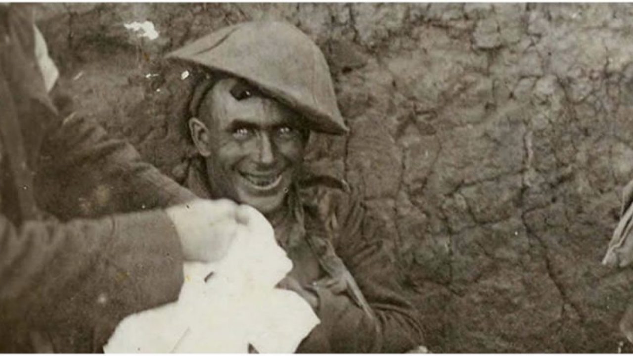 This picture was taken in the 1950-60s. The man lost his chin ...