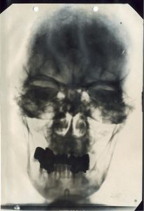 The Russian Translator and Hitler’s Teeth | War History Online